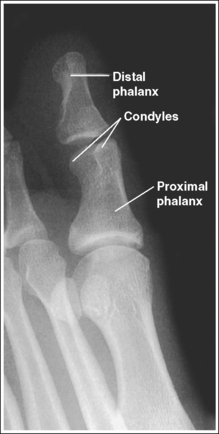 Radiographic Image Analysis