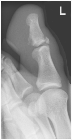 Radiographic Image Analysis