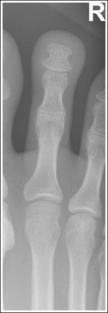 Radiographic Image Analysis