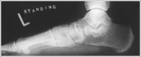 Radiographic Image Analysis