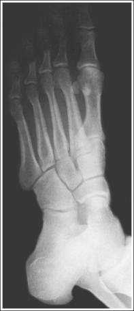 Radiographic Image Analysis