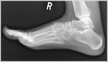Radiographic Image Analysis