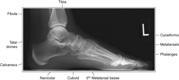 Radiographic Image Analysis