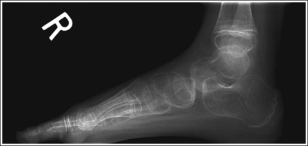 Radiographic Image Analysis