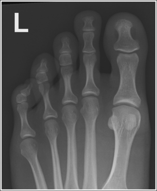 Radiographic Image Analysis