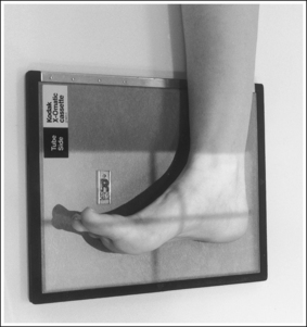 Radiographic Image Analysis