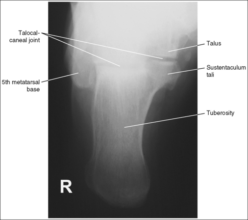 Radiographic Image Analysis