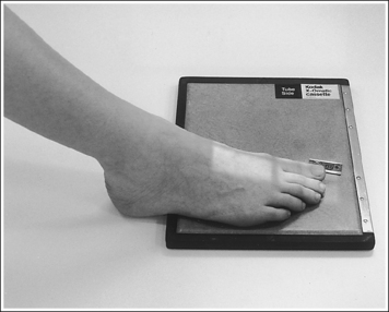 Radiographic Image Analysis