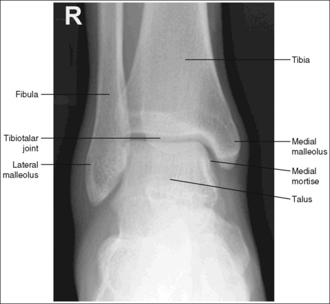 Radiographic Image Analysis
