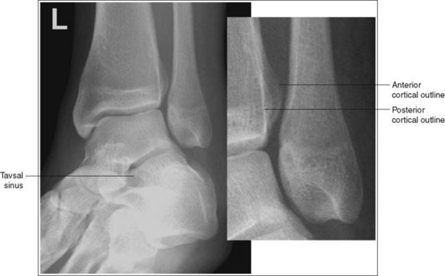 Radiographic Image Analysis