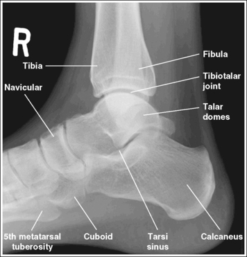Radiographic Image Analysis