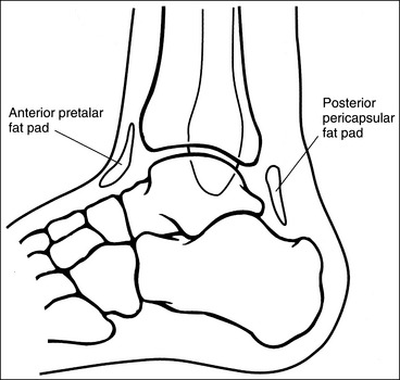 Radiographic Image Analysis