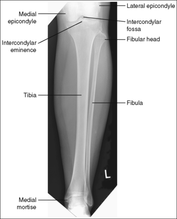 Radiographic Image Analysis