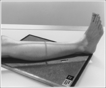 Radiographic Image Analysis