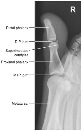 Radiographic Image Analysis