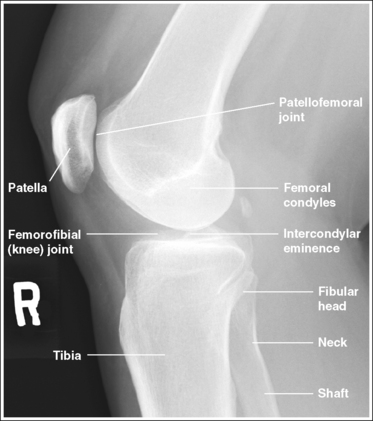Radiographic Image Analysis