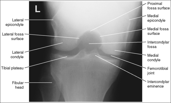 Radiographic Image Analysis