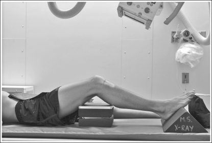 Radiographic Image Analysis