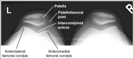 Radiographic Image Analysis