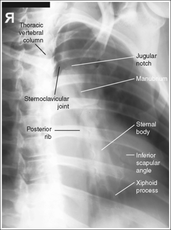 Radiographic Image Analysis