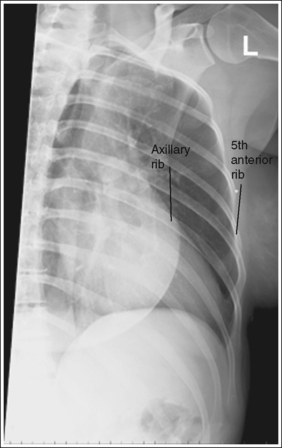 Radiographic Image Analysis