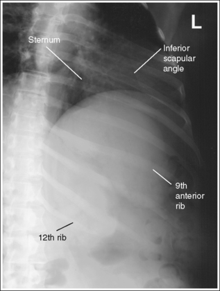 Radiographic Image Analysis