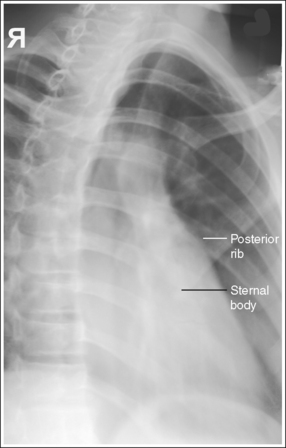 Radiographic Image Analysis