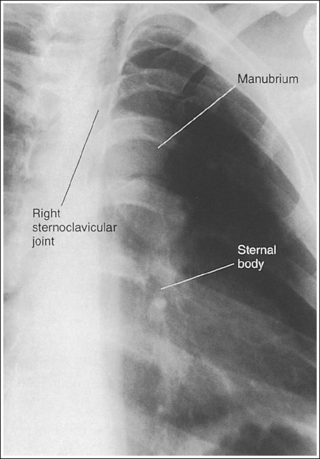 Radiographic Image Analysis