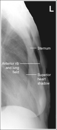 Radiographic Image Analysis