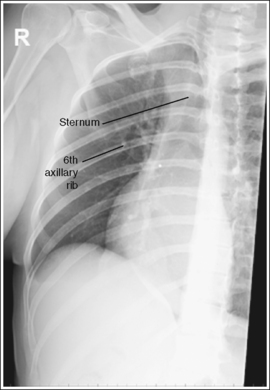 Radiographic Image Analysis