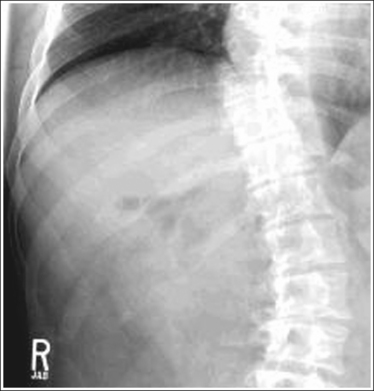 Radiographic Image Analysis