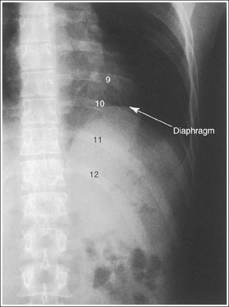 Radiographic Image Analysis