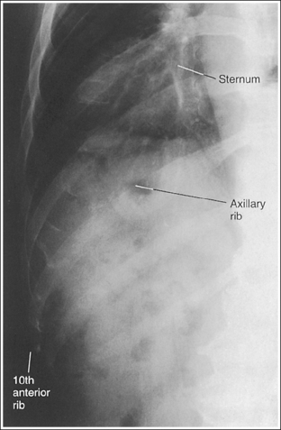 Radiographic Image Analysis