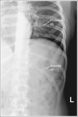 Radiographic Image Analysis