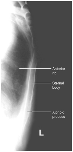 Radiographic Image Analysis