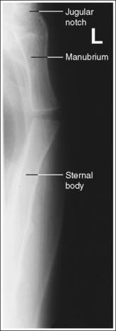 Radiographic Image Analysis