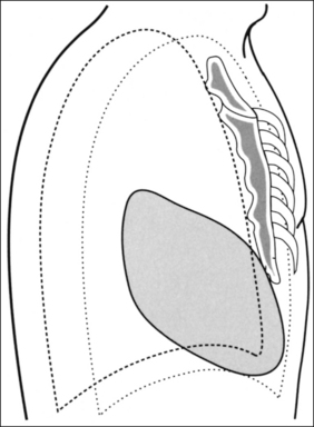 Radiographic Image Analysis