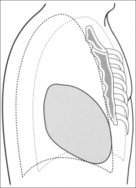 Radiographic Image Analysis