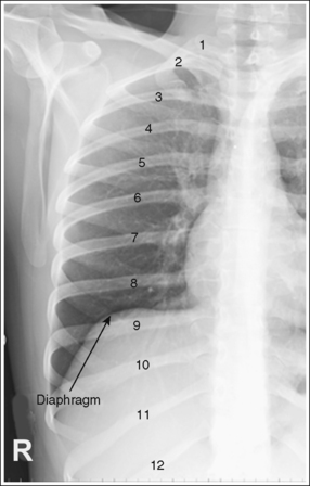 Radiographic Image Analysis