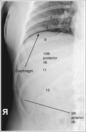 Radiographic Image Analysis
