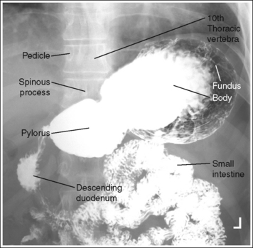 Radiographic Image Analysis
