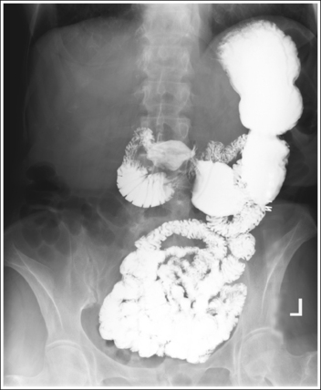 Radiographic Image Analysis