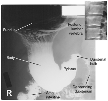 Radiographic Image Analysis