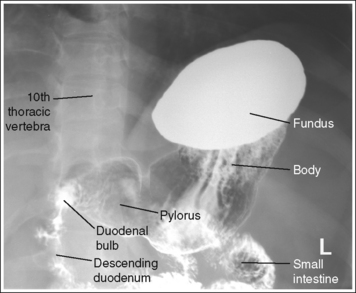 Radiographic Image Analysis
