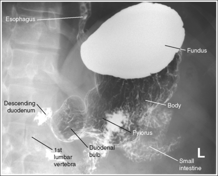 Radiographic Image Analysis