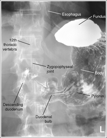 Radiographic Image Analysis