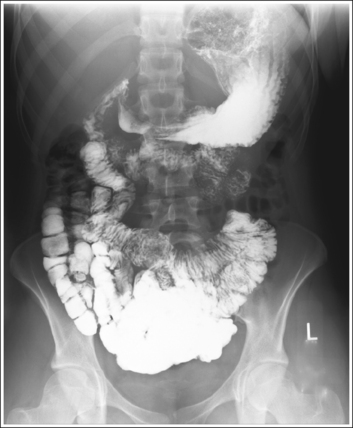 Radiographic Image Analysis