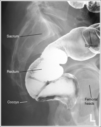 Radiographic Image Analysis