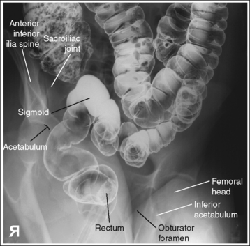 Radiographic Image Analysis