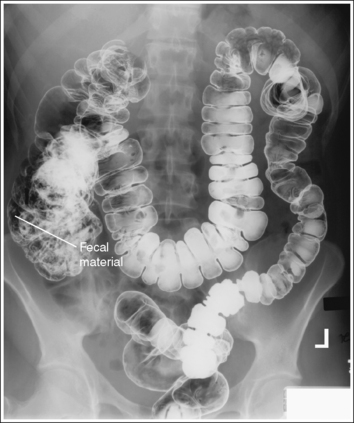 Radiographic Image Analysis